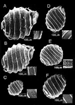 Scanning electron images of six Nitella species | NIWA