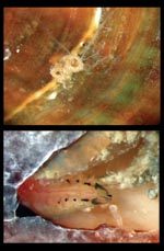Feeding worm projects its palps (top) and worm inside a blister ...