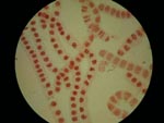 Stained chromosomes from a charophyte cell | Earth Sciences New Zealand ...