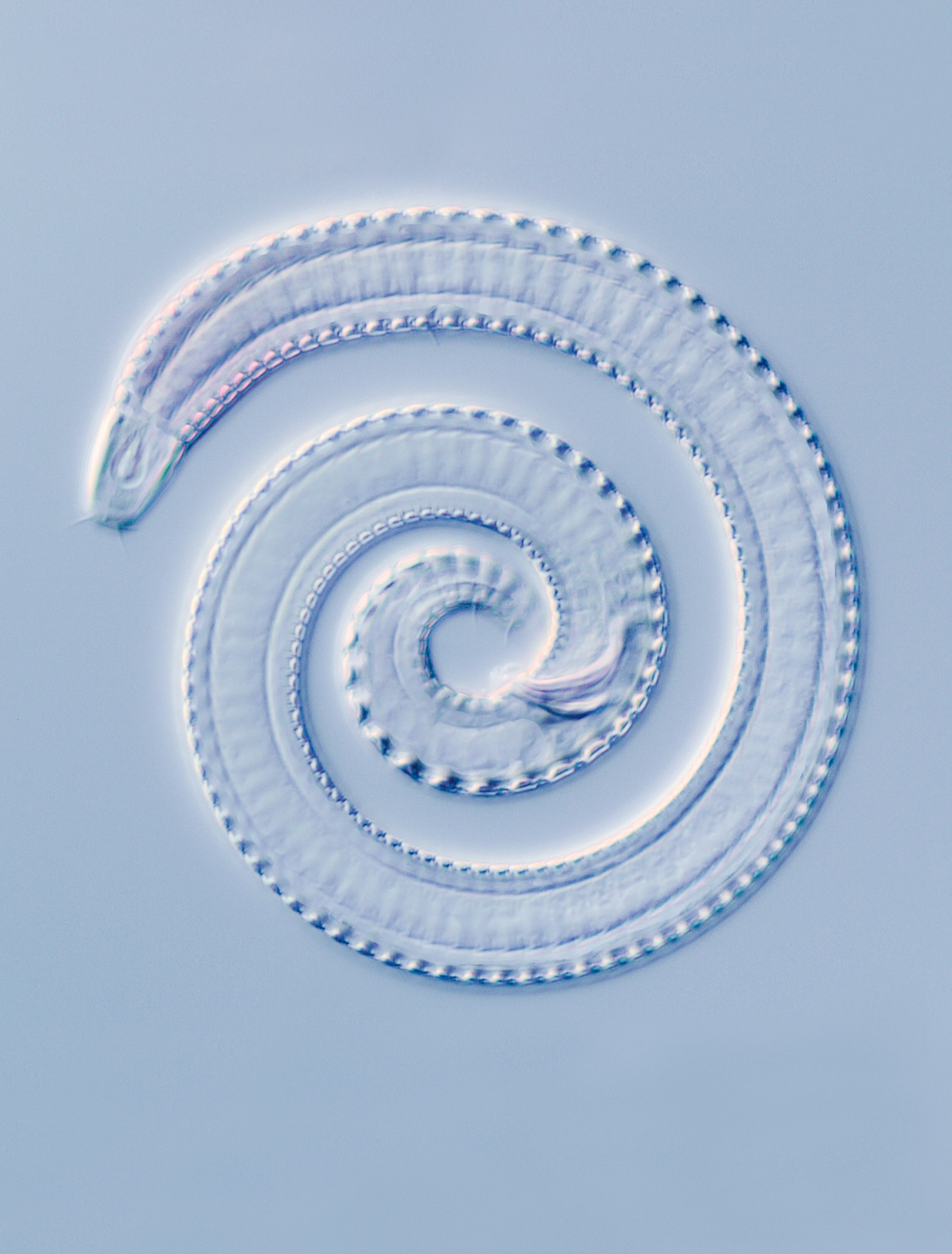 Adult male nematode of the genus Metadasynemella | Earth Sciences New ...