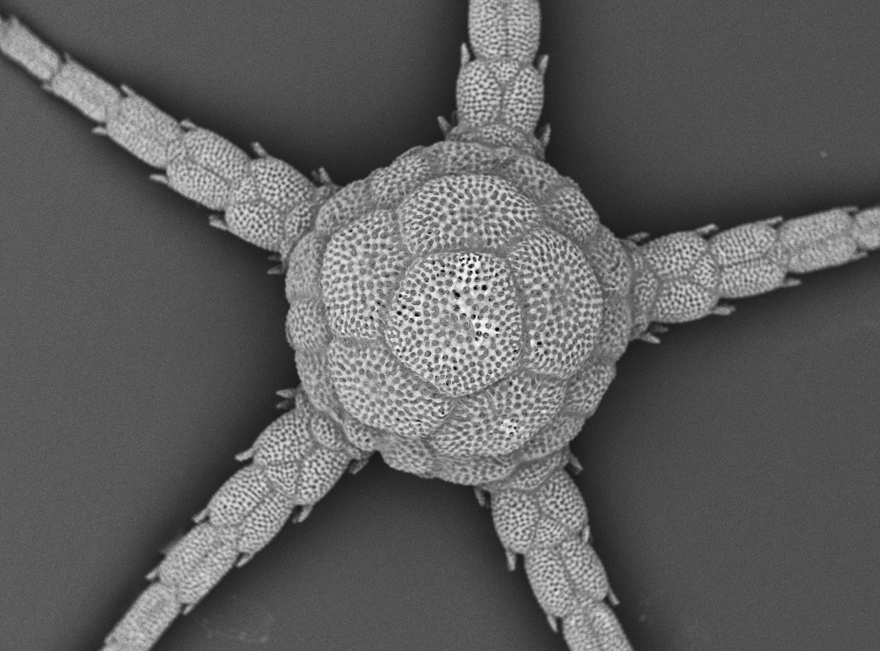 Ophiuroid (brittle star) from Chatham Rise, top view - 1.5 mm (disc ...